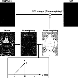 Flowcharts of processing steps of susceptibility-weighted images (SWI).