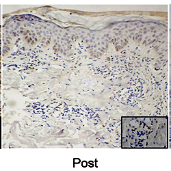 Immuno-histochemical staining of IL-17.
