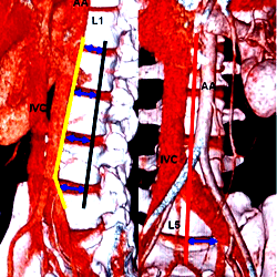 Each level's operative window.