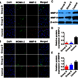 Immunofluorescence and western blot analysis of MMP-2 and MMP-9 ...
