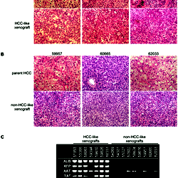 Xenografts arising from human HCC specimens.