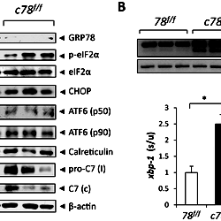 Knockout of GRP78 in BM cells activates UPR signaling pathways.