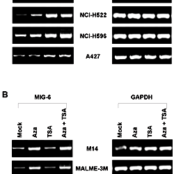 Induction of MIG-6 expression by 5-aza-dC and TSA is regulated at ...