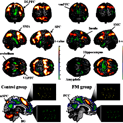 Within group analysis of n-back task.