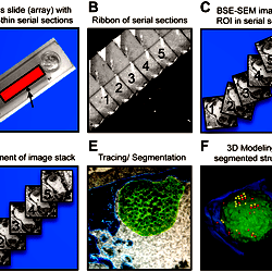 Outline of the serial section array scanning electron microscopy (SSA ...