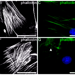 F-actin staining in fibroblasts.