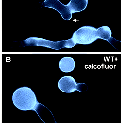 Cell wall differences revealed by calcofluor white.