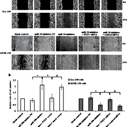 Wound healing assay.