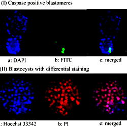 Microphotographs showing fluorescent caspase staining and differential ...