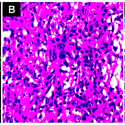 Visualization of the cancerous rat pancreatic samples using nonlinear ...