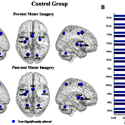 The connectivity degree of pre-tests and post-tests for all ROIs in the ...
