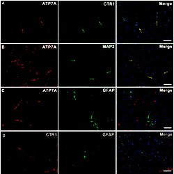 Immunofluorescent staining of ATP7A and CTR1 in neurons and astrocytes ...