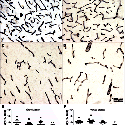 Capillary density in gray matter and white matter.