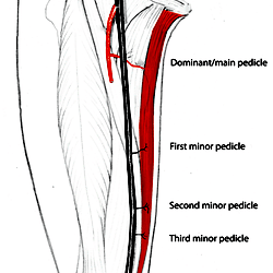Blood supply to the gracilis flap clarifying the nomenclature to be ...