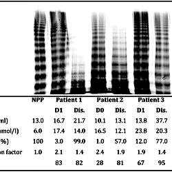 VWF multimer pattern in Indonesian children with dengue.