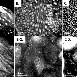 LC3β immunofluorescence staining of human samples to identify ...