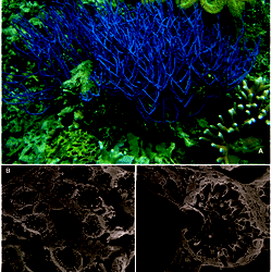 Porifera morphology and internal structure.