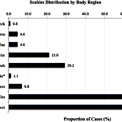 Scabies distribution by body region.