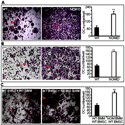 OC differentiation is increased in NOMID cells.