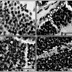 Organizational differences in the granule cells of the DG.