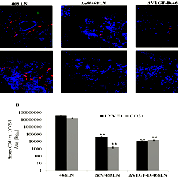 Intra-tumoral lymphangiogenesis (LYVE-1 immunostatining-red) as well as ...
