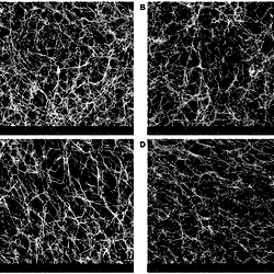 Fibrin structure assessed by SEM.