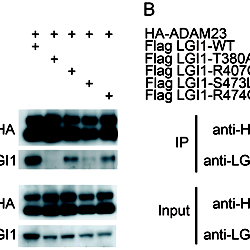 LGI1 mutations impair interaction with ADAM22 and ADAM23.