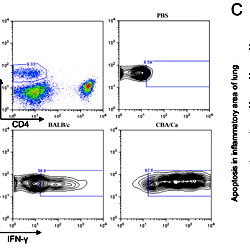 CBA/Ca mice display uncontrolled lung inflammation and associated ...
