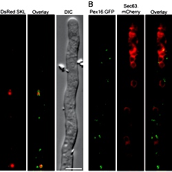 P. chrysogenum Pex16 is a peroxisomal membrane protein.