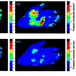 Mapping the PPG-waveform amplitude.