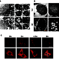 Morphological alteration of mitochondria in AβPP/PS1 mice brains and ...