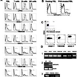 Results of sera screening by FACS on PBL and Cord Blood cells.