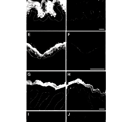 TGase 3 expression in epithelia.