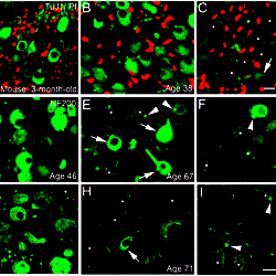 Age-related changes in TuJ1 and NF 200 expression in human ears.