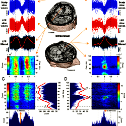 Two patterns of phasic modulation of gamma oscillations by the slow waves.