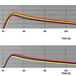 Time-intensity curves prepared by ROI software to show temporal changes ...