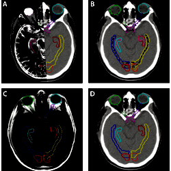 Identification of cryptic critical structures.