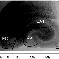 Overview of the perforant pathway transection (PPT) in OHSC.