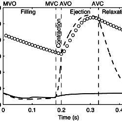 Evolution of simulated left atrial, left ventricular and aortic ...