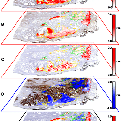 Generation of an IHC Signature Map.