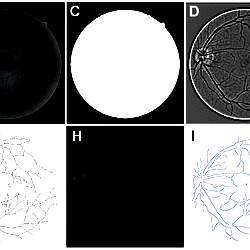 Overview of the main steps taken by our algorithm when processing a ...