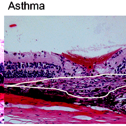H&E staining of representative areas of CNV.