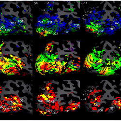 Retinotopic organization of the lateral visual cortex.