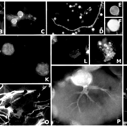 Examples of fungal morphologies.