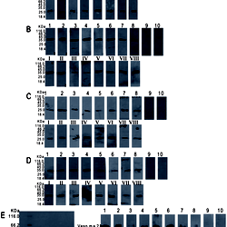 Immunoblot of IgE reactivity to Vesp ma 5(A), Vesp ma 2(B), Tab y 5(C ...