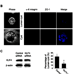 KLF4 is essential for cell polarity and crypt-cyst formation in 3D ...