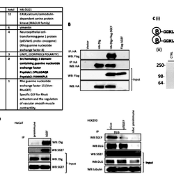 Identification of SGEF as an interacting partner of Dlg.