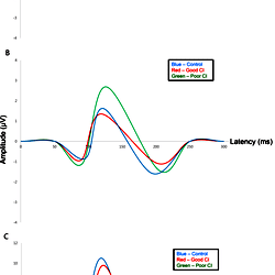 Average waveforms of VEP from three different groups in study population.
