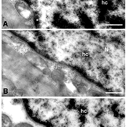 Nuclear activity as heterochromatin mass by electron microscopy in ...