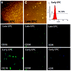 Morphology and characterization of human endothelial progenitor cells ...